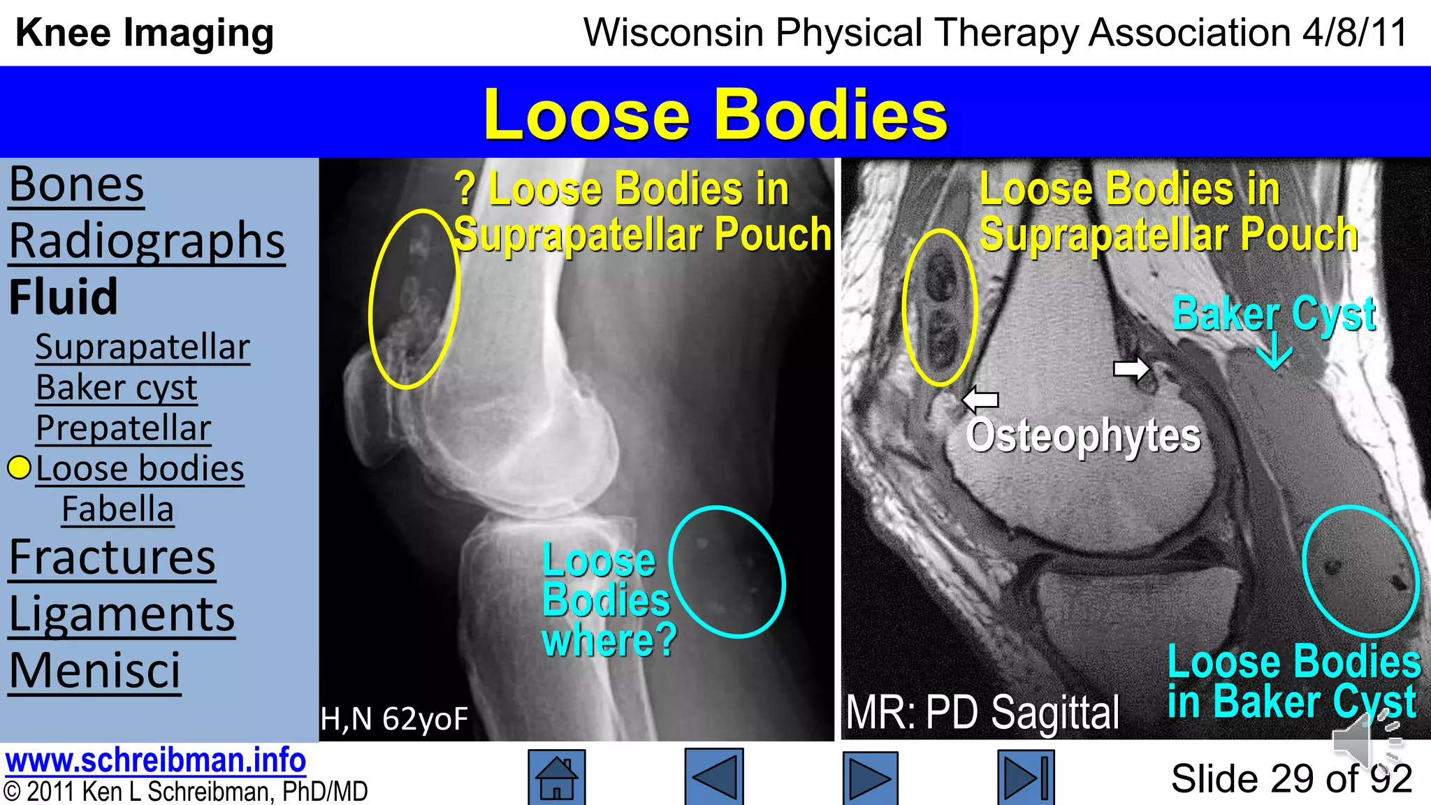 Knee Imaging narrated MSK Radiology Lecture | PPT