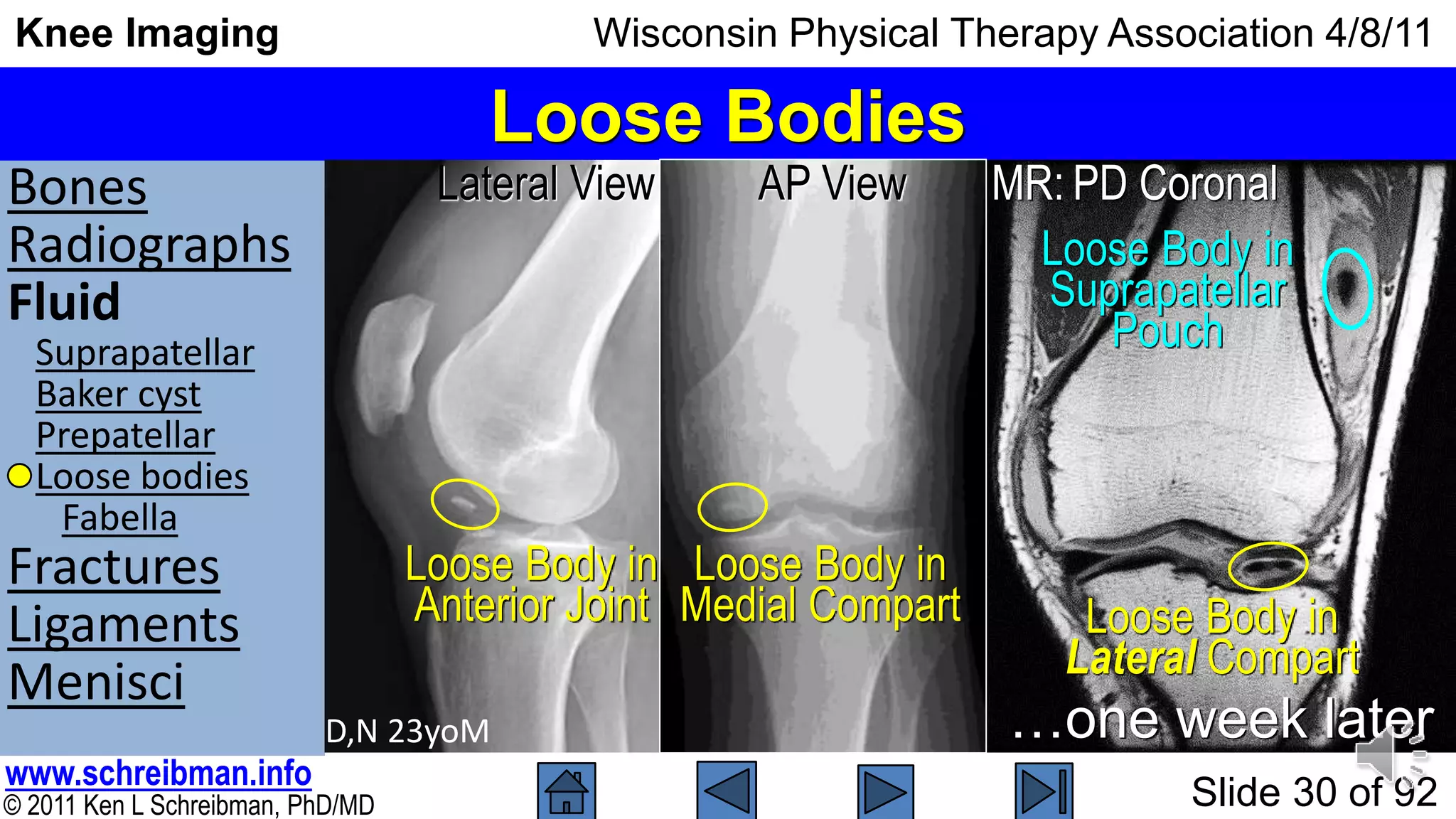 Knee Imaging narrated MSK Radiology Lecture | PPT