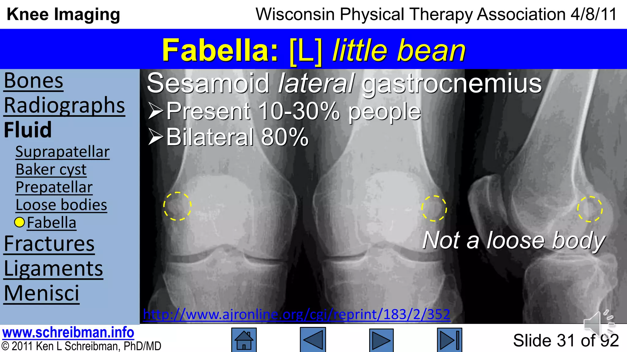 Knee Imaging narrated MSK Radiology Lecture | PPT