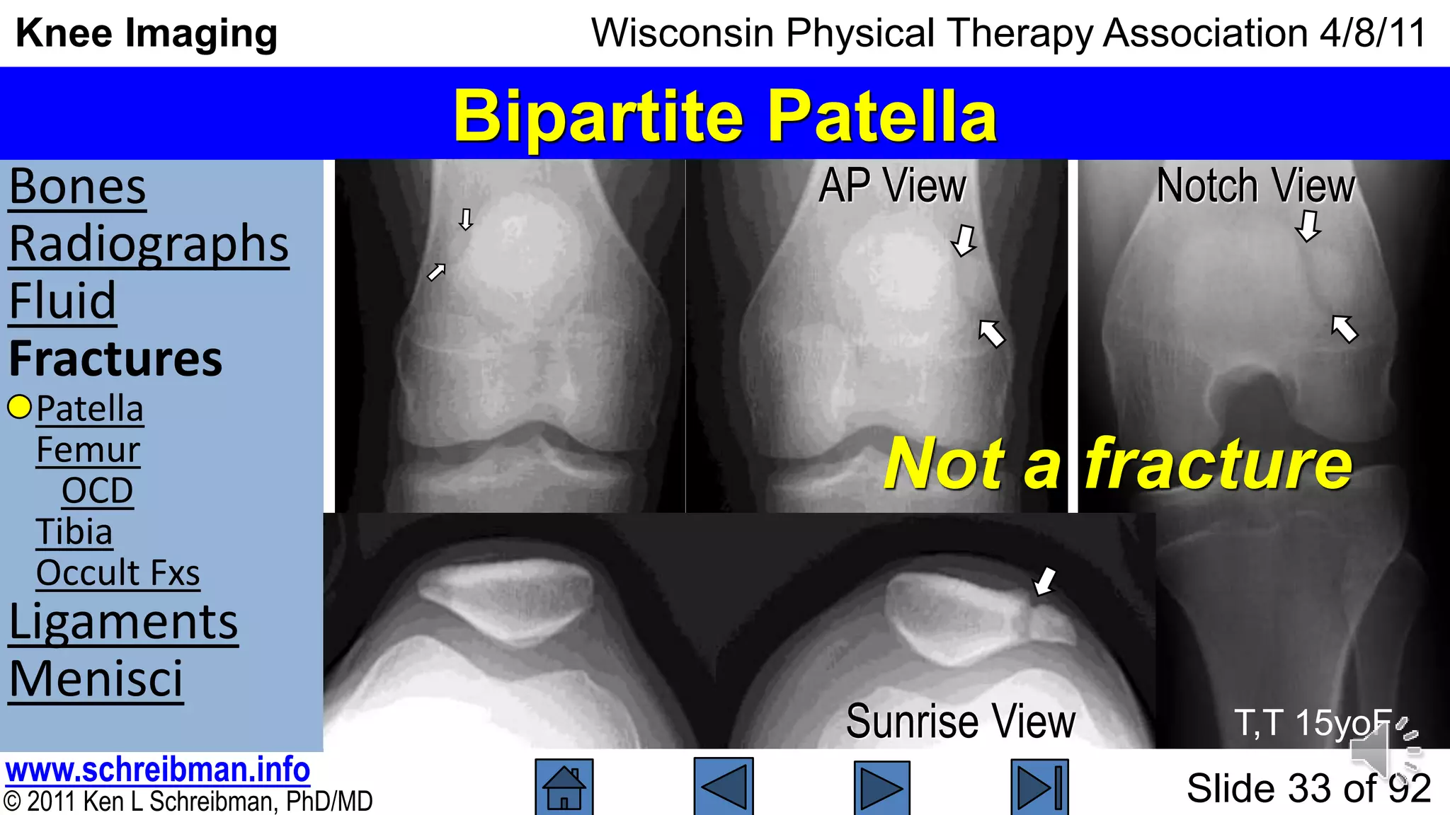 Knee Imaging narrated MSK Radiology Lecture | PPT