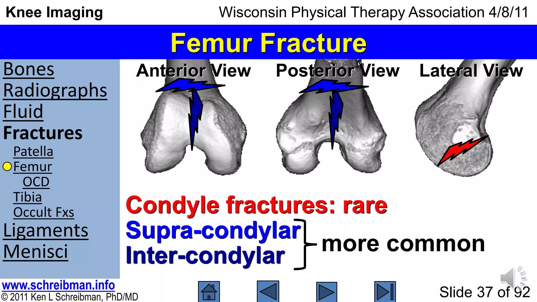 Knee Imaging narrated MSK Radiology Lecture | PPT