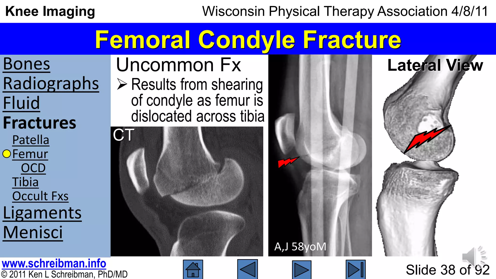 Knee Imaging narrated MSK Radiology Lecture | PPT