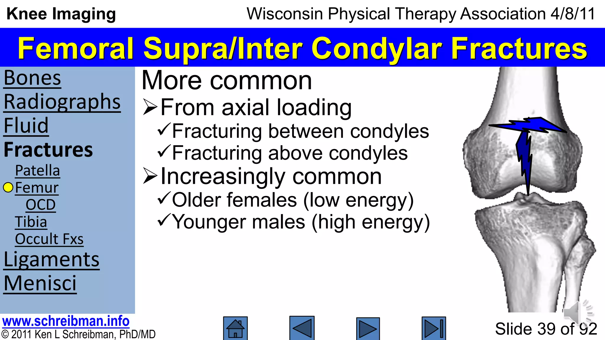 Knee Imaging narrated MSK Radiology Lecture | PPT