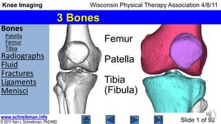 Knee Imaging narrated MSK Radiology Lecture | PPT