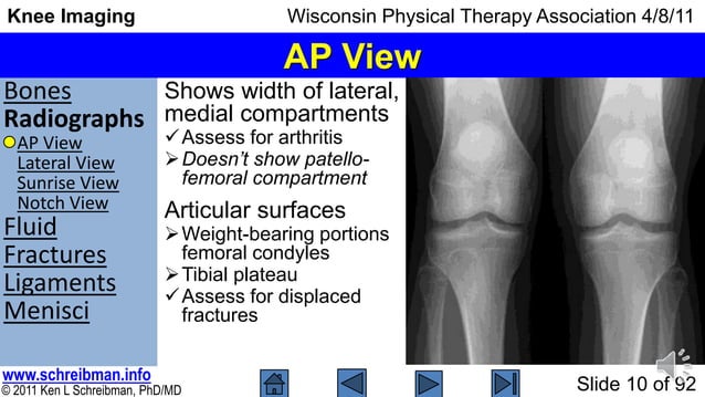 Knee Imaging narrated MSK Radiology Lecture | PPT