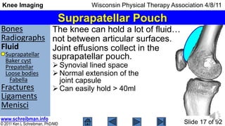 Knee Imaging narrated MSK Radiology Lecture | PPSX