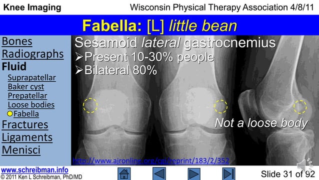 Knee Imaging narrated MSK Radiology Lecture | PPT