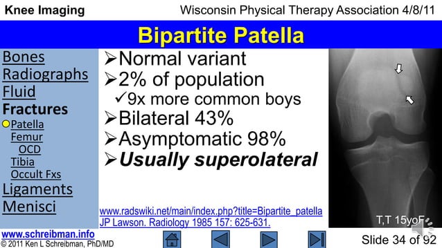 Knee Imaging narrated MSK Radiology Lecture | PPT