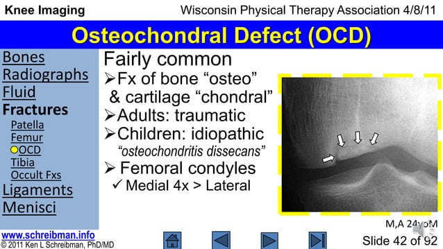 Knee Imaging narrated MSK Radiology Lecture | PPT