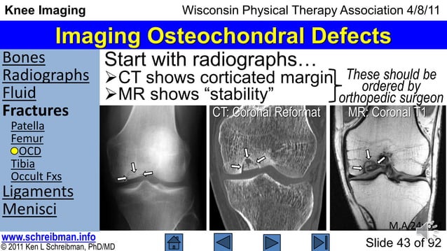 Knee Imaging narrated MSK Radiology Lecture | PPT