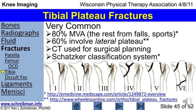 Knee Imaging narrated MSK Radiology Lecture | PPT