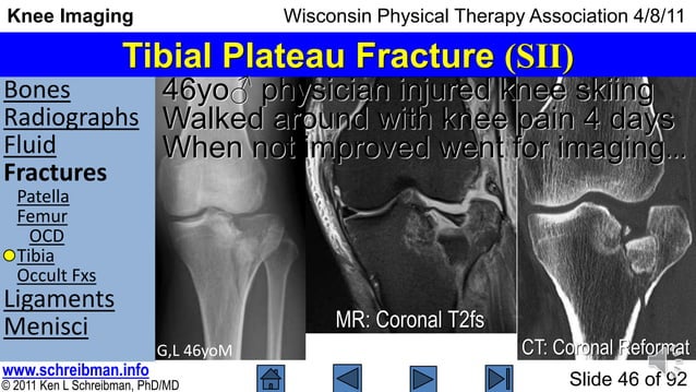 Knee Imaging narrated MSK Radiology Lecture | PPT