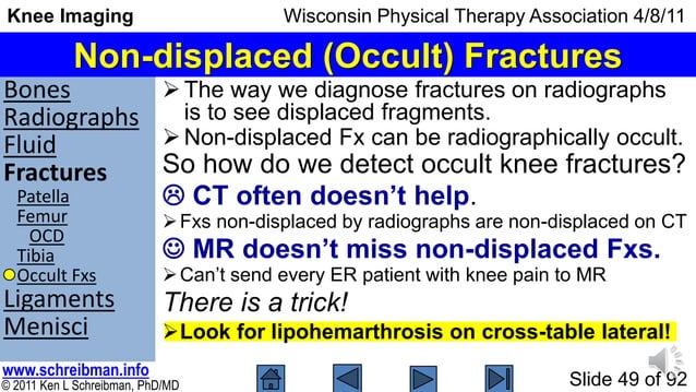 Knee Imaging narrated MSK Radiology Lecture | PPT