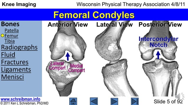 Knee Imaging narrated MSK Radiology Lecture | PPT