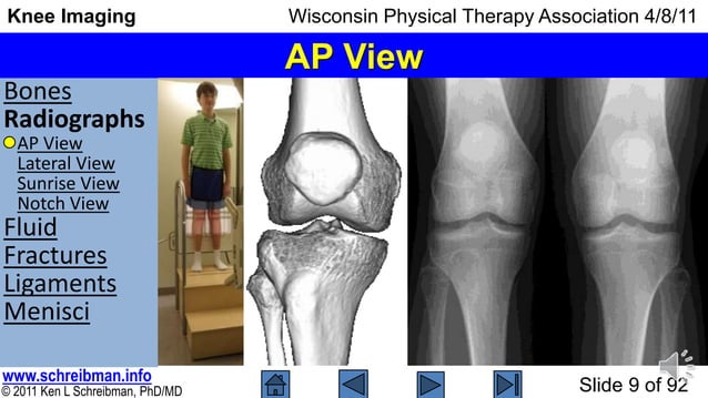 Knee Imaging narrated MSK Radiology Lecture | PPT