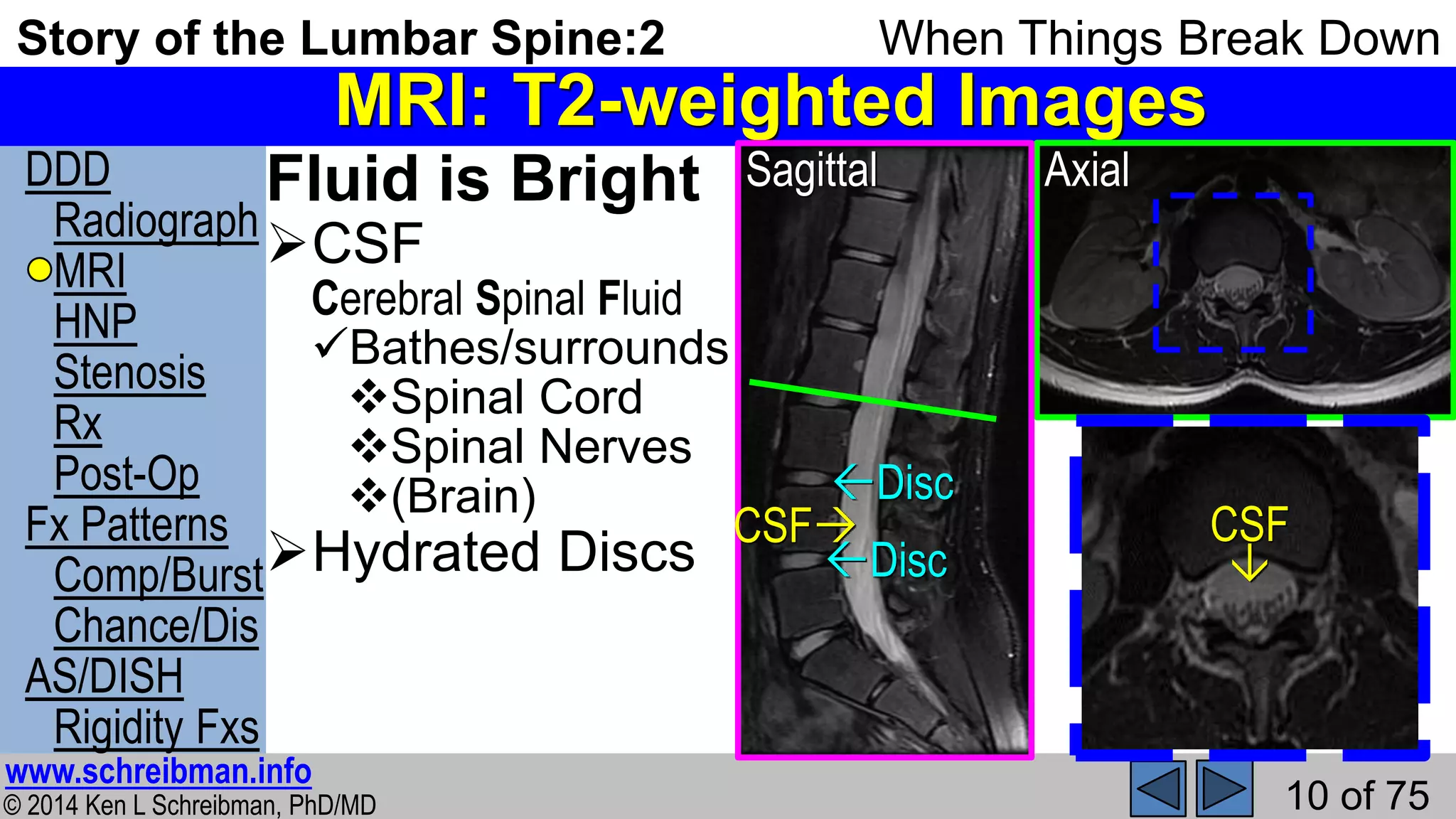 Story of the Lumbar Spine 2 When Things Break Down | PPSX