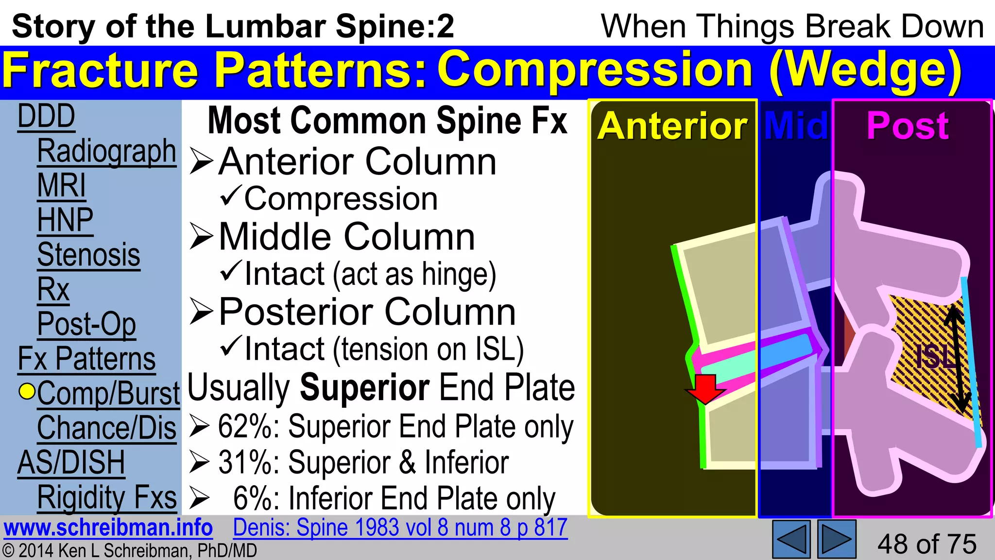 Story of the Lumbar Spine 2 When Things Break Down | PPSX