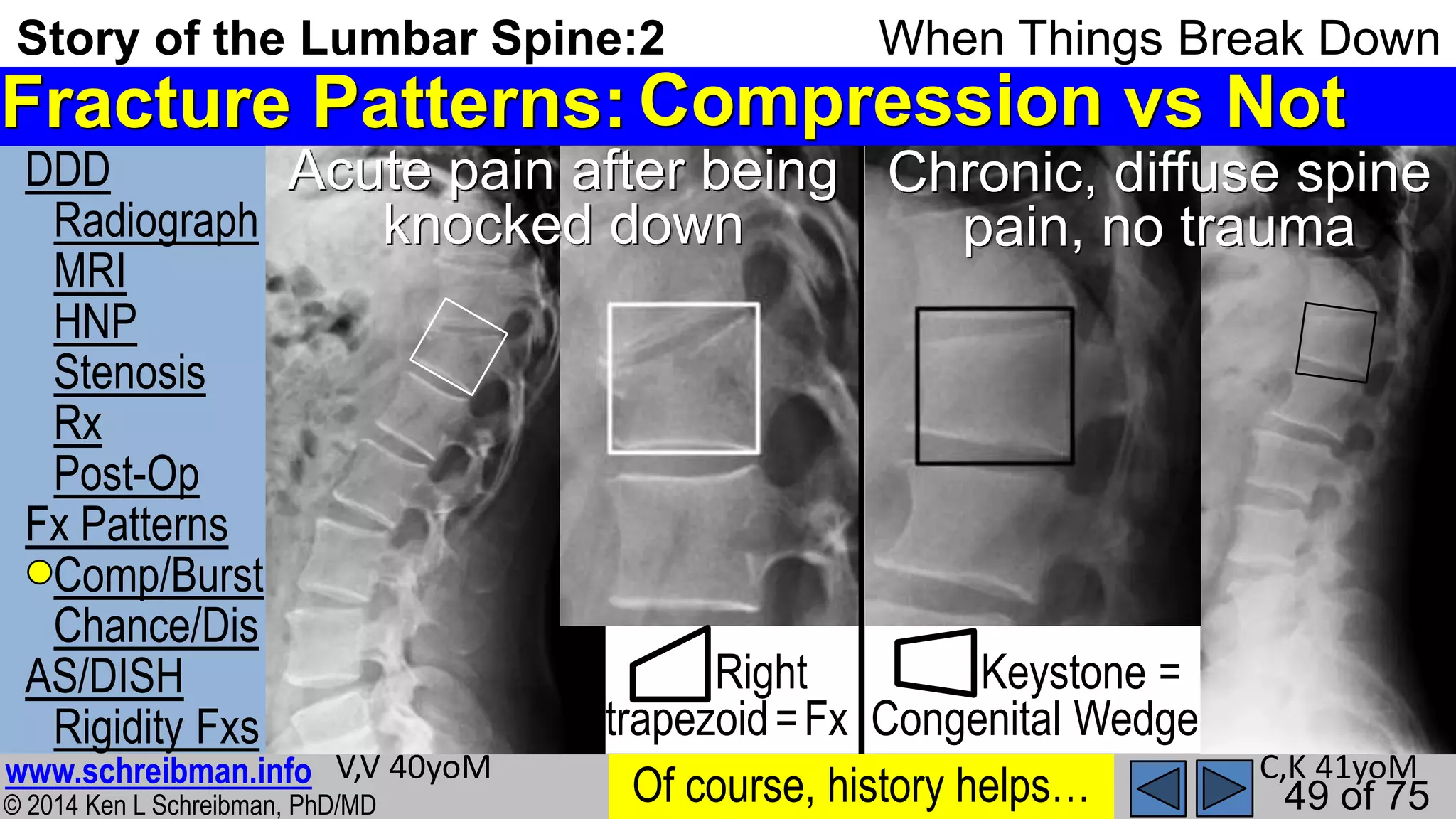 Story of the Lumbar Spine 2 When Things Break Down | PPSX