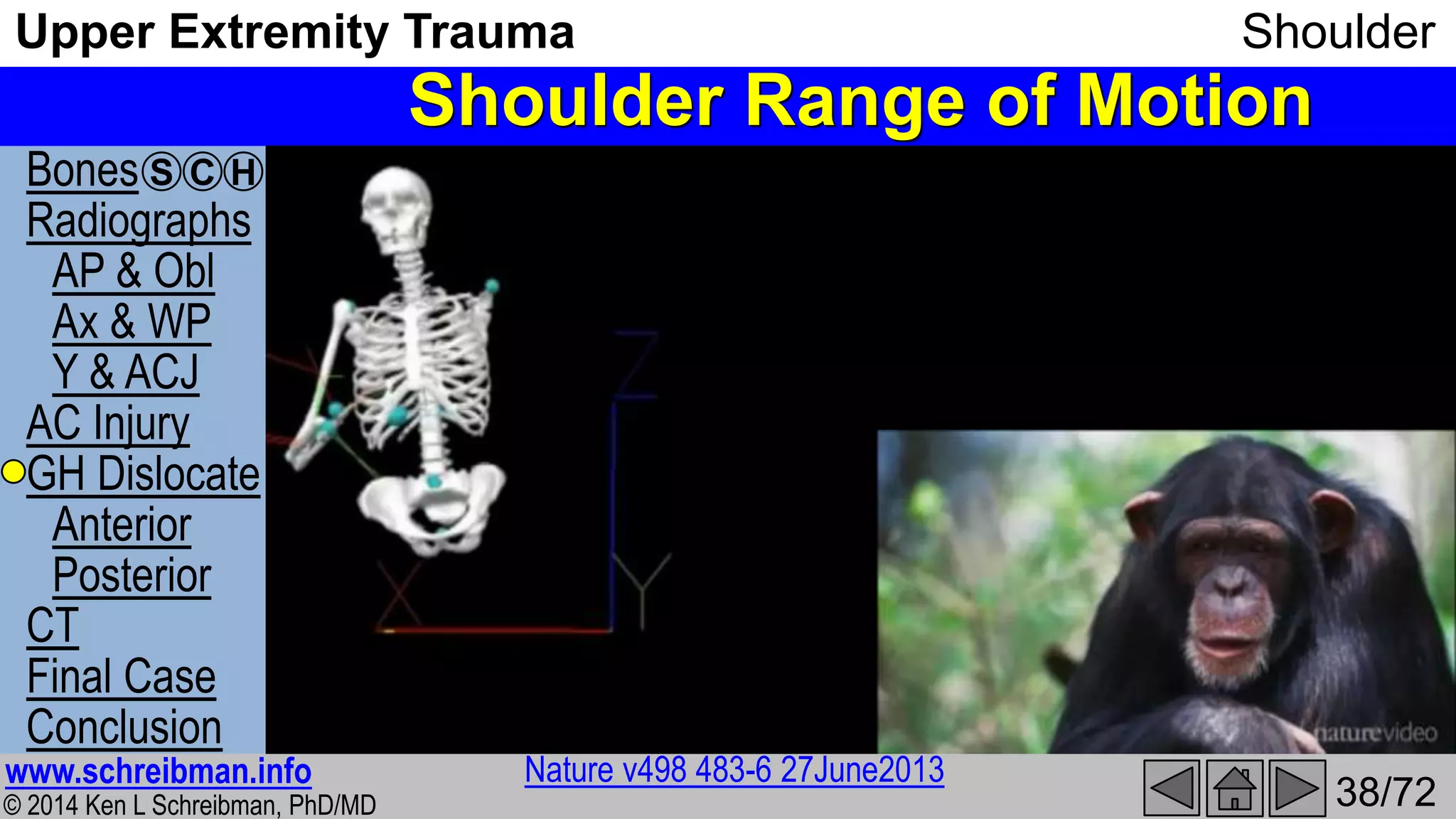 Upper Extremity Trauma Shoulder | PPT