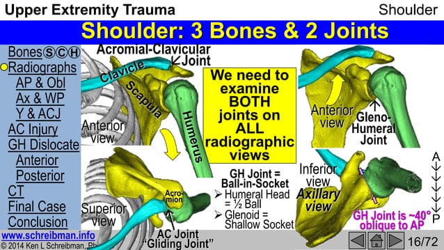 Upper Extremity Trauma Shoulder | PPT