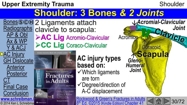 Upper Extremity Trauma Shoulder | PPT