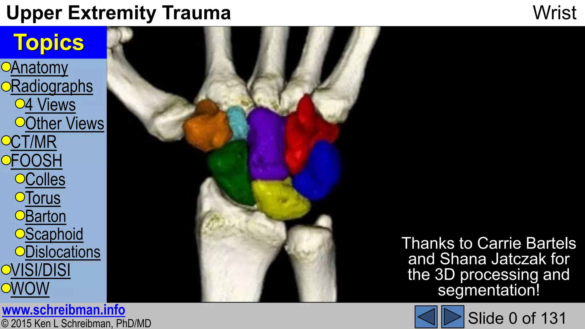 Upper Extremity Trauma Wrist complete MSK Radiology Lecture | PPT