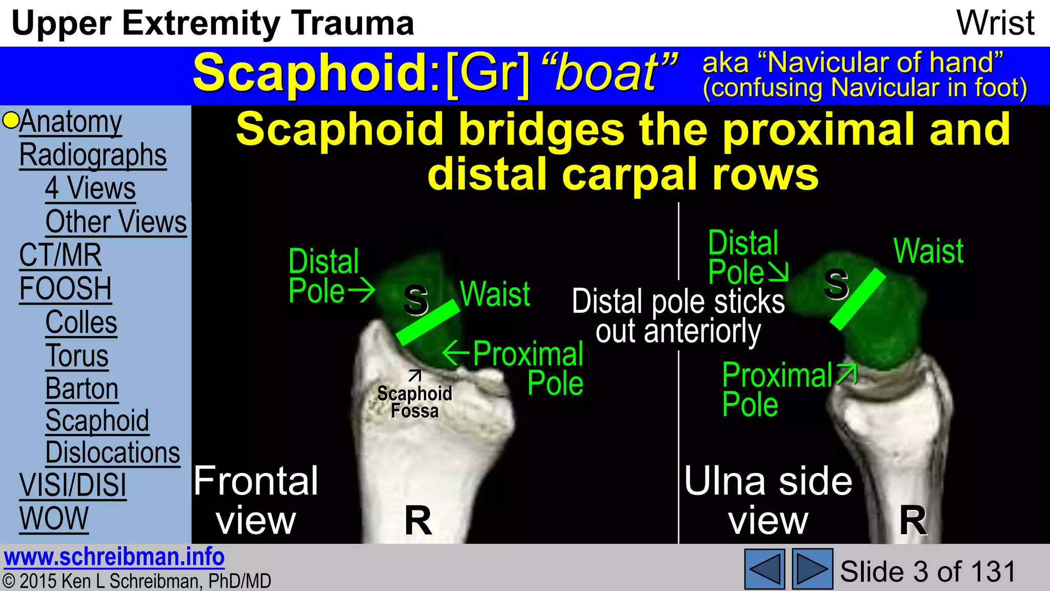 Upper Extremity Trauma Wrist complete MSK Radiology Lecture | PPT