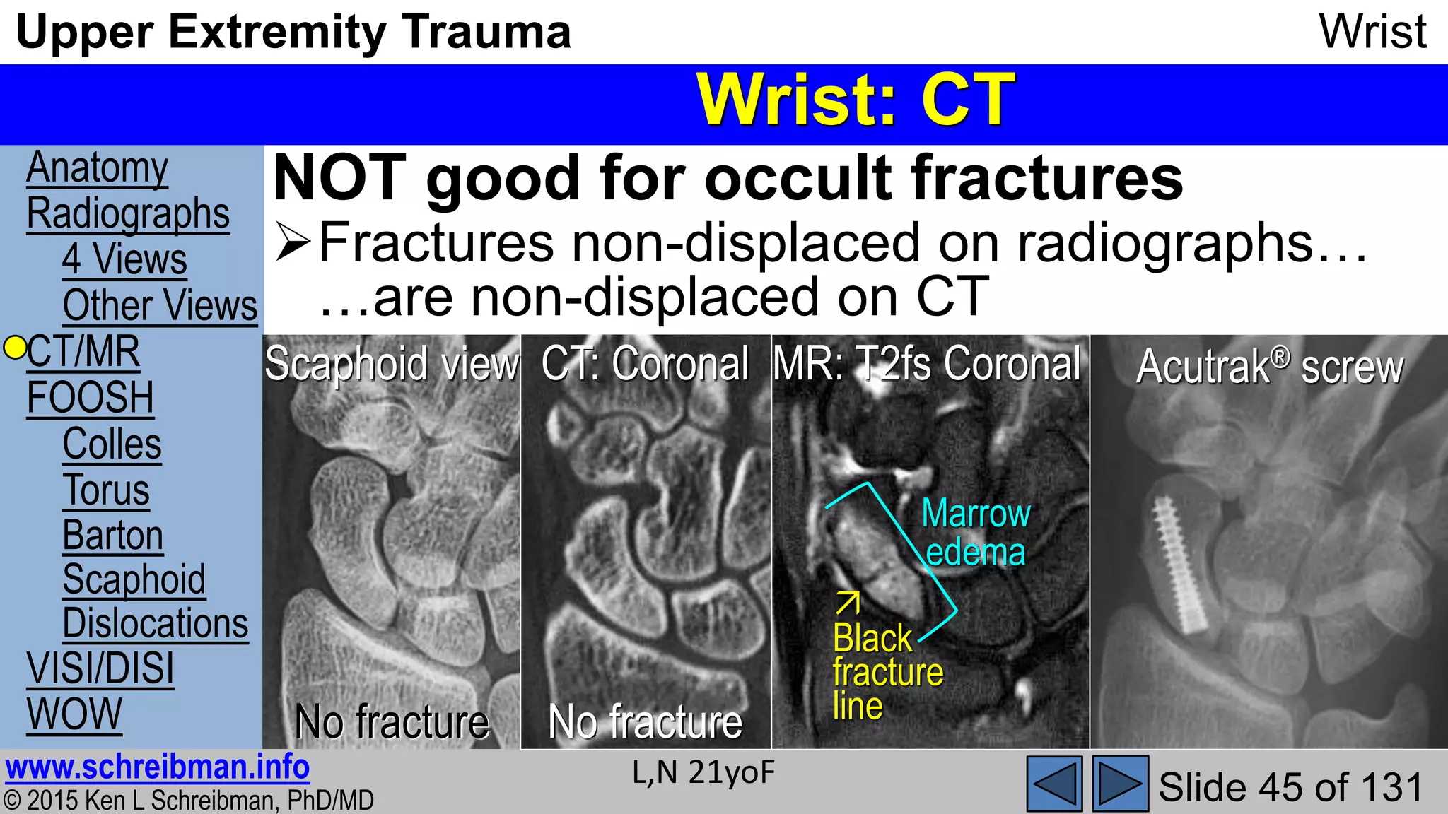 Upper Extremity Trauma Wrist complete MSK Radiology Lecture | PPT