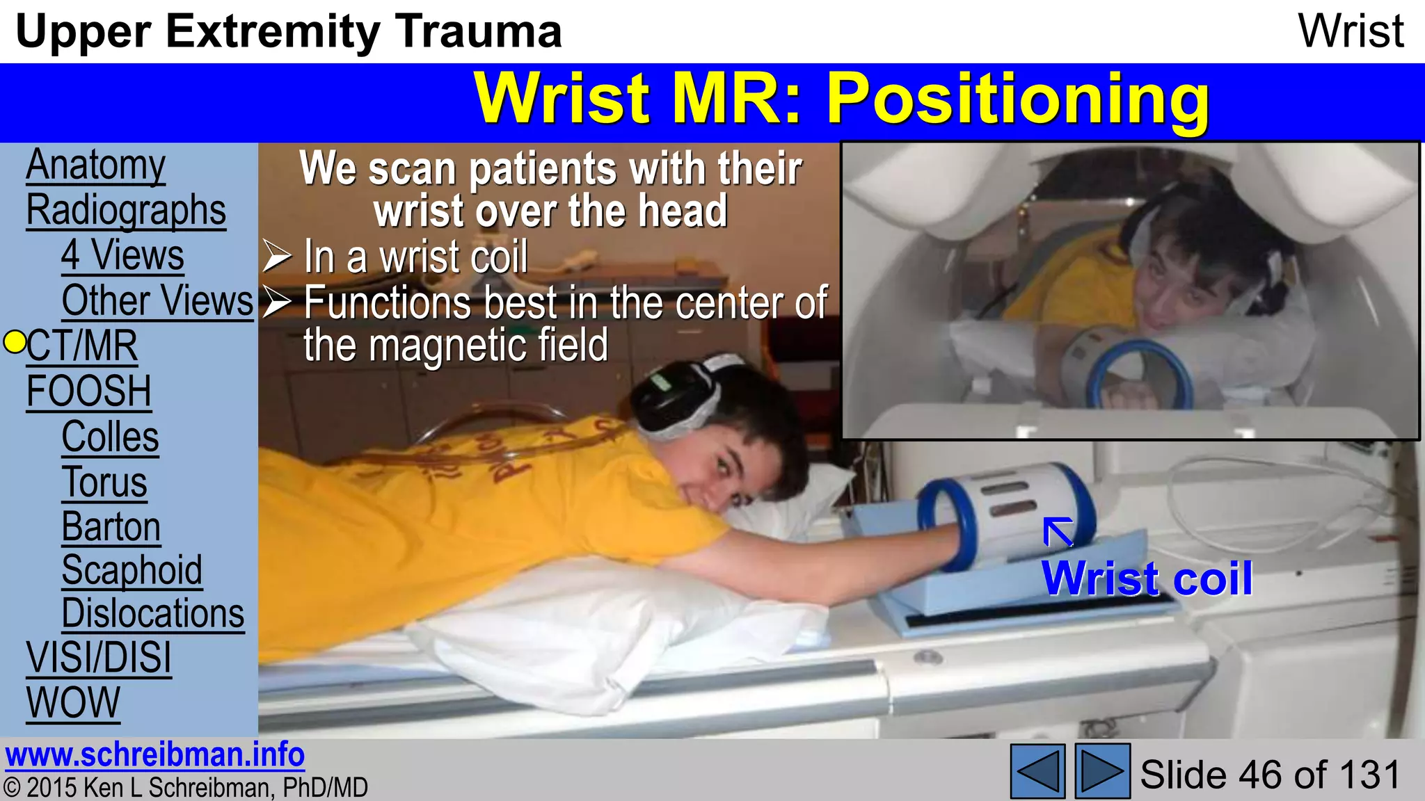 Upper Extremity Trauma Wrist complete MSK Radiology Lecture | PPT