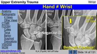 Upper Extremity Trauma Wrist complete MSK Radiology Lecture | PPSX