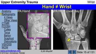 Upper Extremity Trauma Wrist complete MSK Radiology Lecture | PPSX