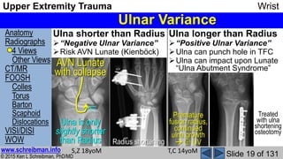 Upper Extremity Trauma Wrist complete MSK Radiology Lecture | PPSX