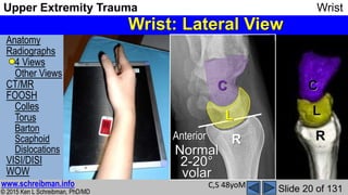 Upper Extremity Trauma Wrist complete MSK Radiology Lecture | PPSX