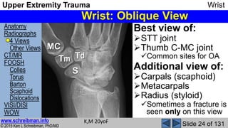 Upper Extremity Trauma Wrist complete MSK Radiology Lecture | PPSX