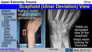 Upper Extremity Trauma Wrist complete MSK Radiology Lecture | PPSX