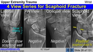 Upper Extremity Trauma Wrist complete MSK Radiology Lecture | PPSX