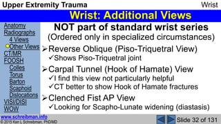Upper Extremity Trauma Wrist complete MSK Radiology Lecture | PPSX