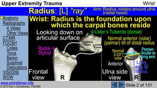 Upper Extremity Trauma Wrist complete MSK Radiology Lecture | PPSX
