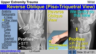 Upper Extremity Trauma Wrist complete MSK Radiology Lecture | PPSX
