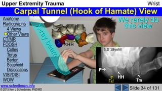 Upper Extremity Trauma Wrist complete MSK Radiology Lecture | PPSX