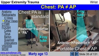 Upper Extremity Trauma Wrist complete MSK Radiology Lecture | PPSX