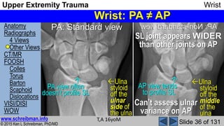 Upper Extremity Trauma Wrist complete MSK Radiology Lecture | PPSX