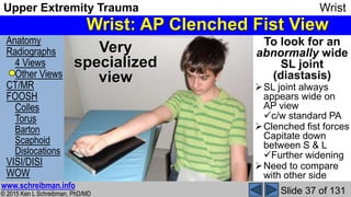 Upper Extremity Trauma Wrist complete MSK Radiology Lecture | PPSX