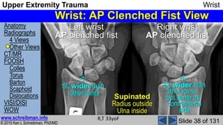 Upper Extremity Trauma Wrist complete MSK Radiology Lecture | PPSX