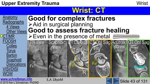 Upper Extremity Trauma Wrist complete MSK Radiology Lecture | PPT