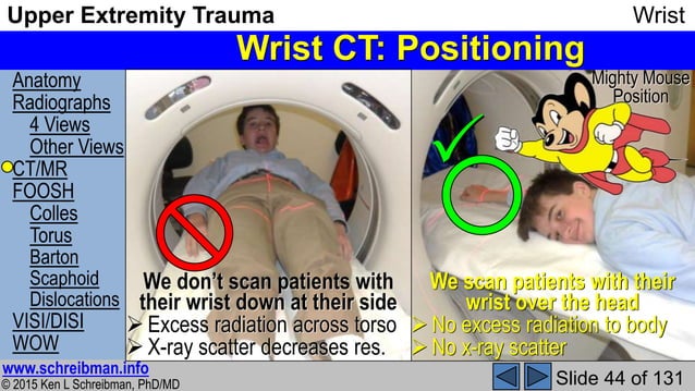 Upper Extremity Trauma Wrist complete MSK Radiology Lecture | PPT