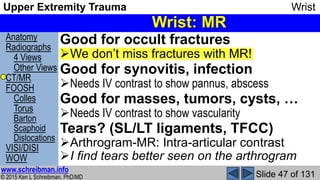 Upper Extremity Trauma Wrist complete MSK Radiology Lecture | PPSX