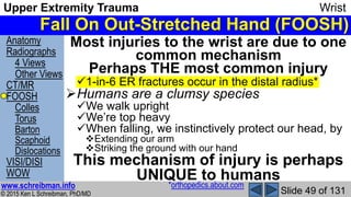 Upper Extremity Trauma Wrist complete MSK Radiology Lecture | PPSX