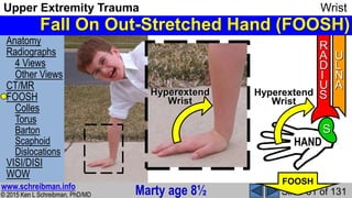 Upper Extremity Trauma Wrist complete MSK Radiology Lecture | PPSX