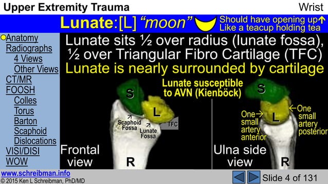 Upper Extremity Trauma Wrist complete MSK Radiology Lecture | PPT